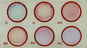 Widal Test : Principle, Procedure, Result Interpretation and ...