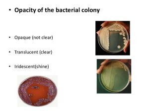 Colony Morphology of Various Bacteria - Laboratoryinfo.com