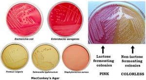 Colony Morphology of Various Bacteria - Laboratoryinfo.com