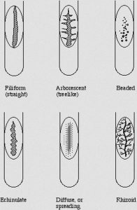 Colony Morphology of Various Bacteria - Laboratoryinfo.com