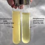 ONPG Test (for β-galactosidase) - How to do (Principle), Results ...